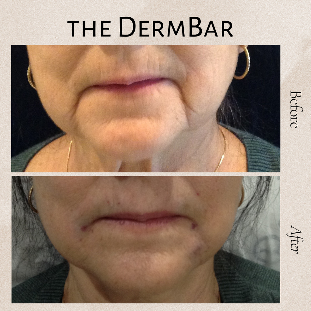 The Derm Bar Physician Led Medical & Cosmetic Dermatology Ontario CA ...